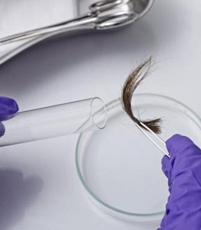 Hair Analysis - Dr. O. Solutions for Natural Health